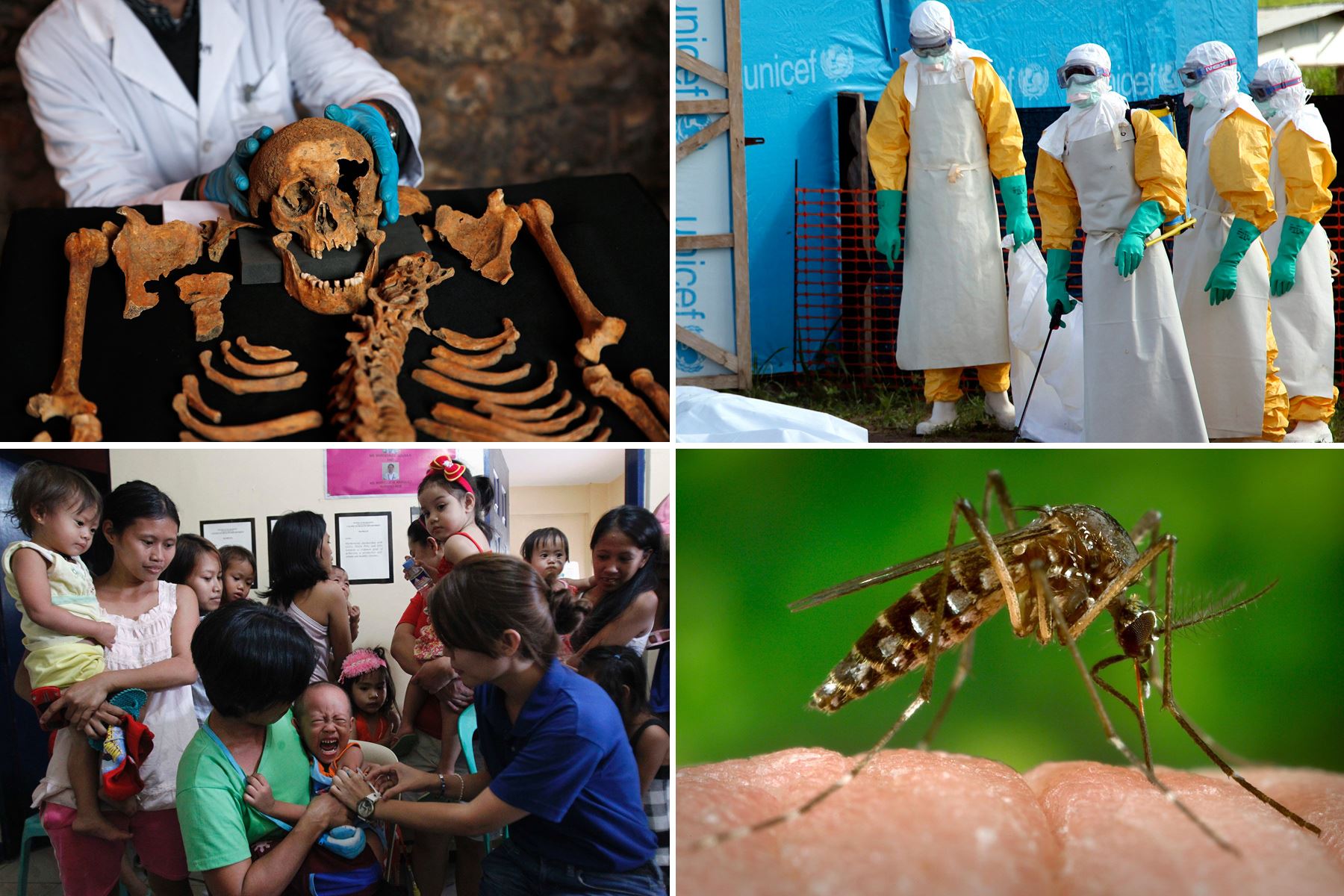 20 deadliest diseases in human history